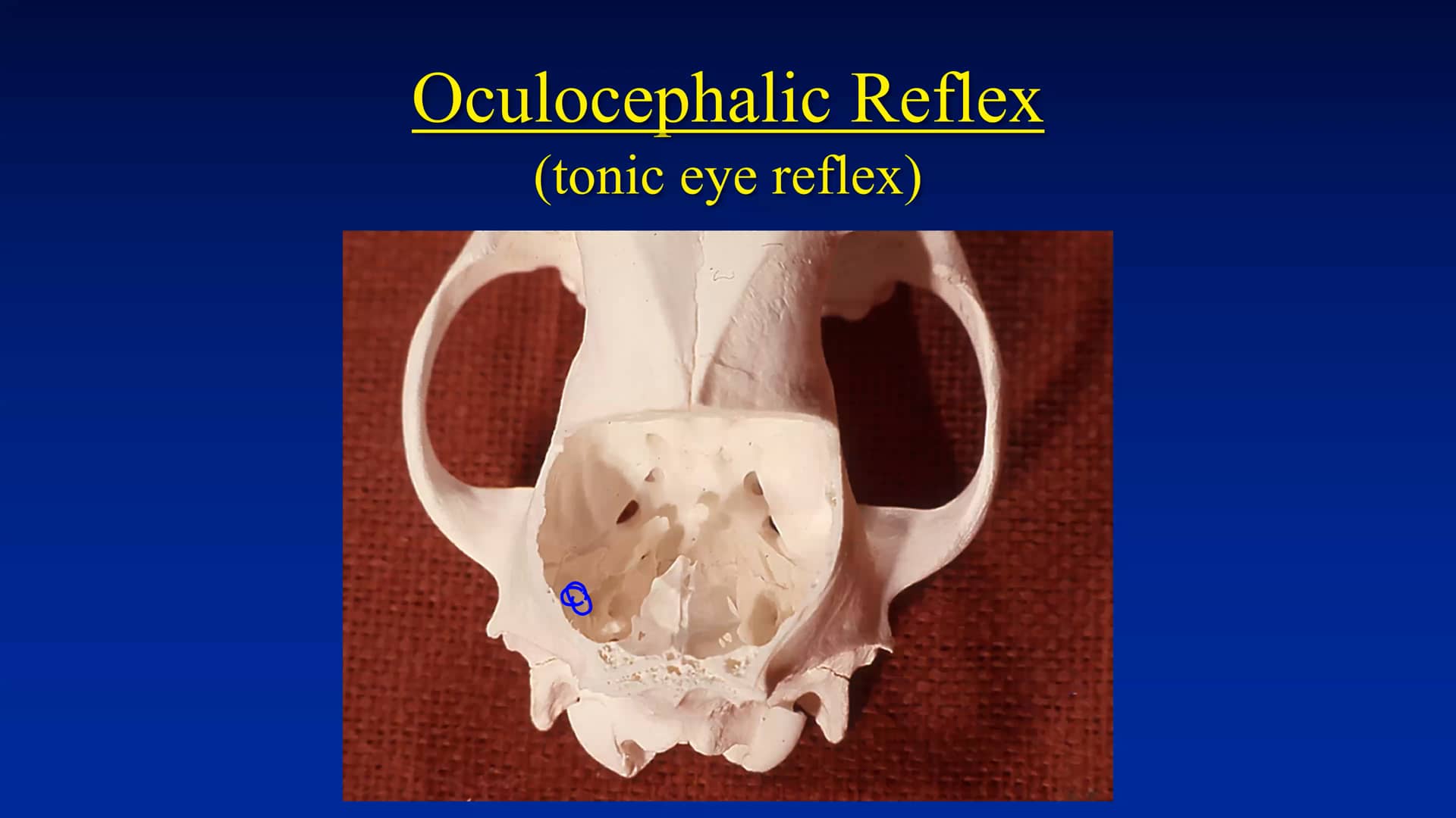 Oculocephlic Reflex on Vimeo