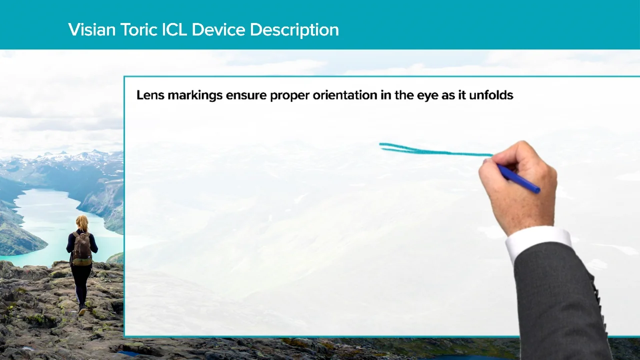Visian Toric ICL Training Video 2 on Vimeo
