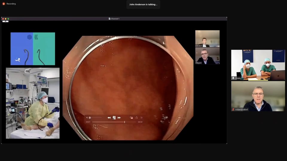 Case 3 - Live Training in Colonoscopy: Focus on Tip Control, Patient ...