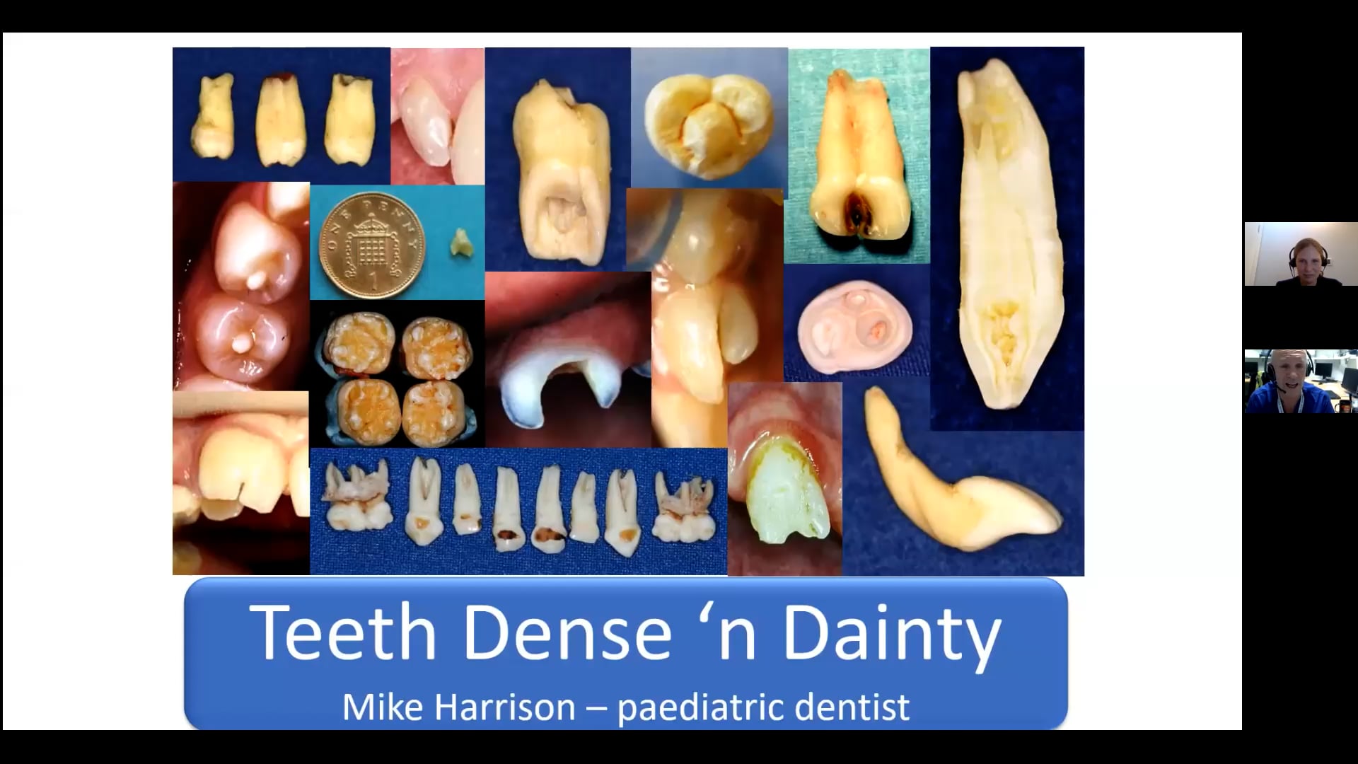 Teeth - Dense and dainty - Mike Harrison on Vimeo