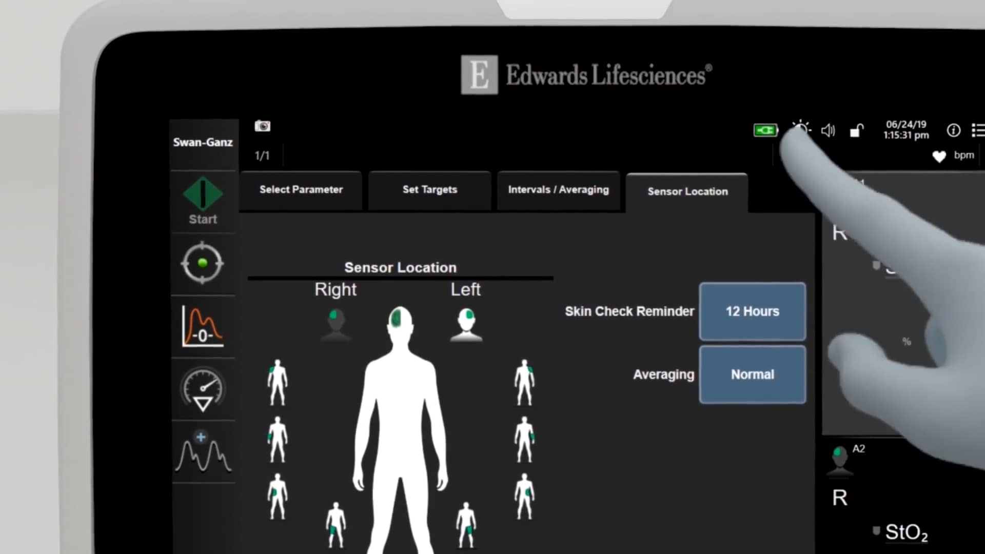 ForeSight (cerebral tissue oximetry) setup on Vimeo