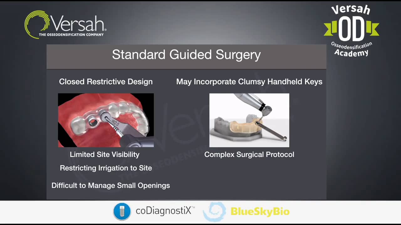 Introduction to Versah® Guided Surgery System.mp4 on Vimeo