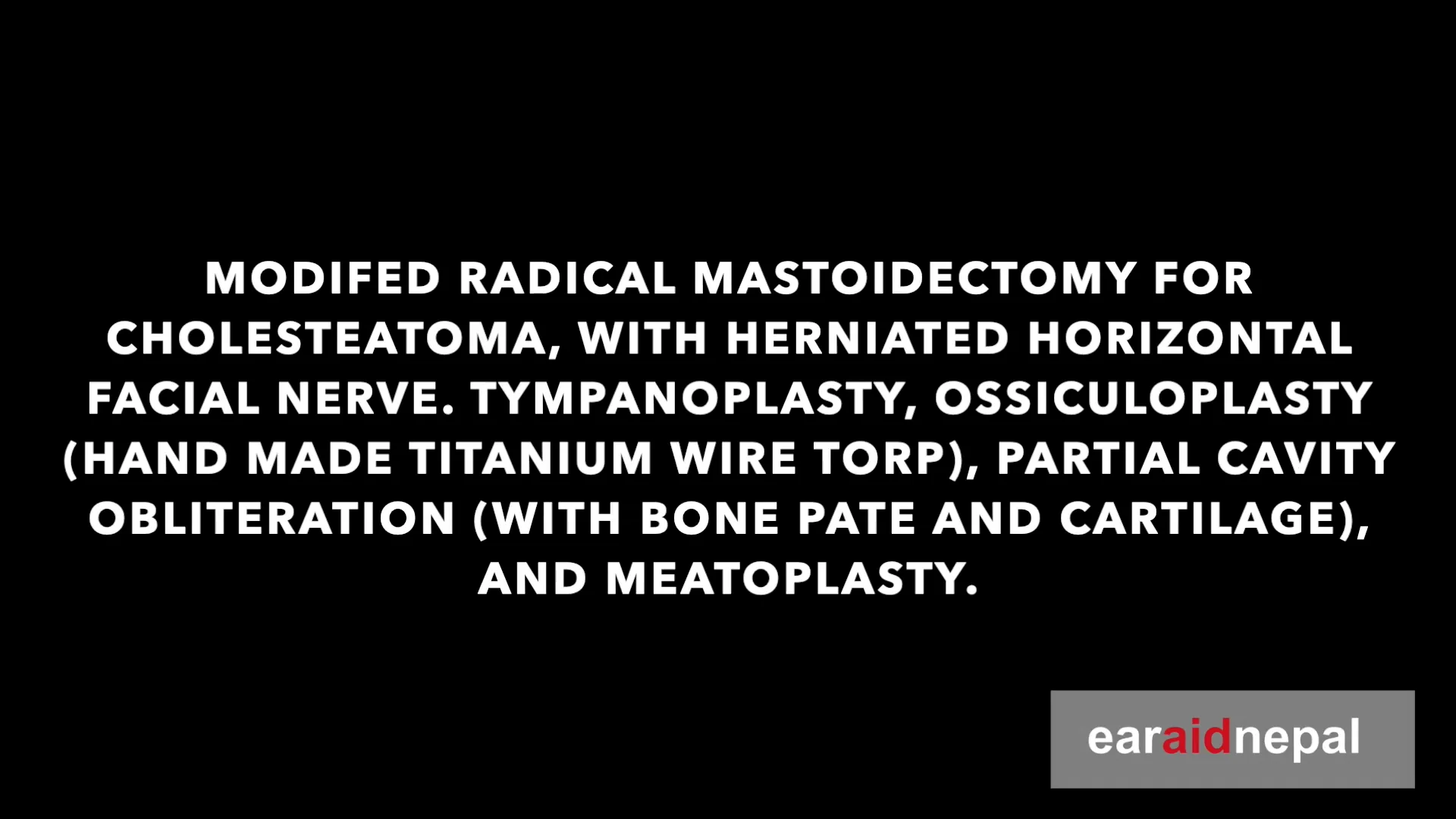 7.3 MRM, cavity obliteration, titanium hand made wire TORP, herniated ...