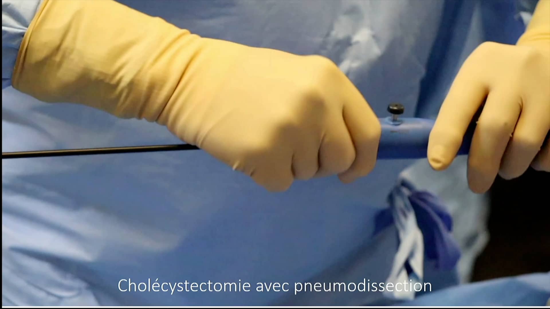 Symposium AB MEDICA : La pneumodissection dans la prise en charge des ...