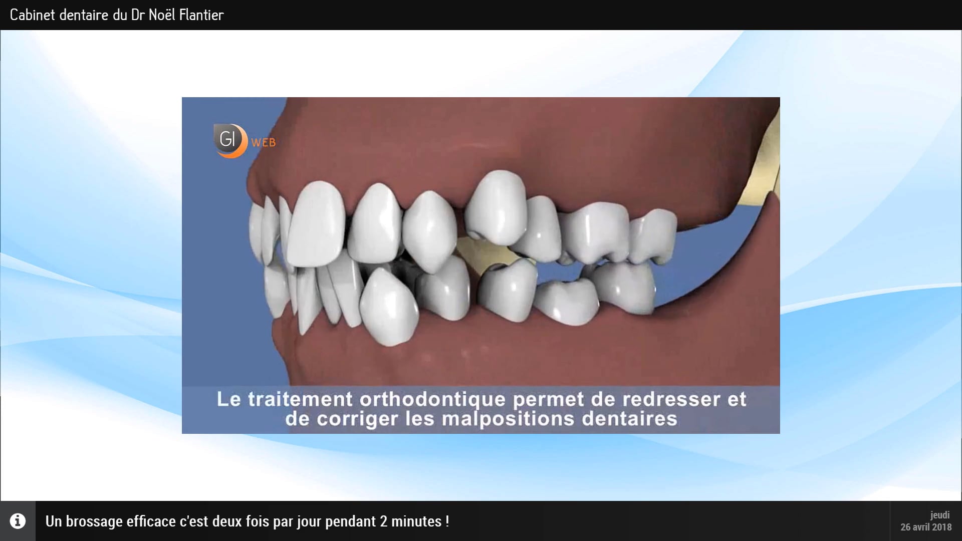 Fil de contention.mp4 on Vimeo