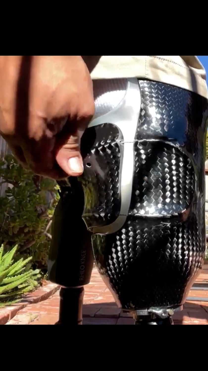 Prosthetics and Orthotics Solutions | Adjustable Prosthetic Socket ...