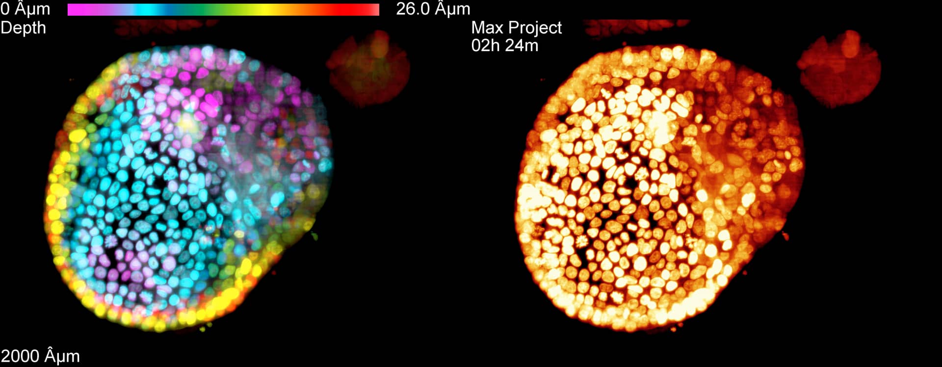 Mouse Intestinal Tumor Organoid with NL5, stained for GFP. Long-term ...