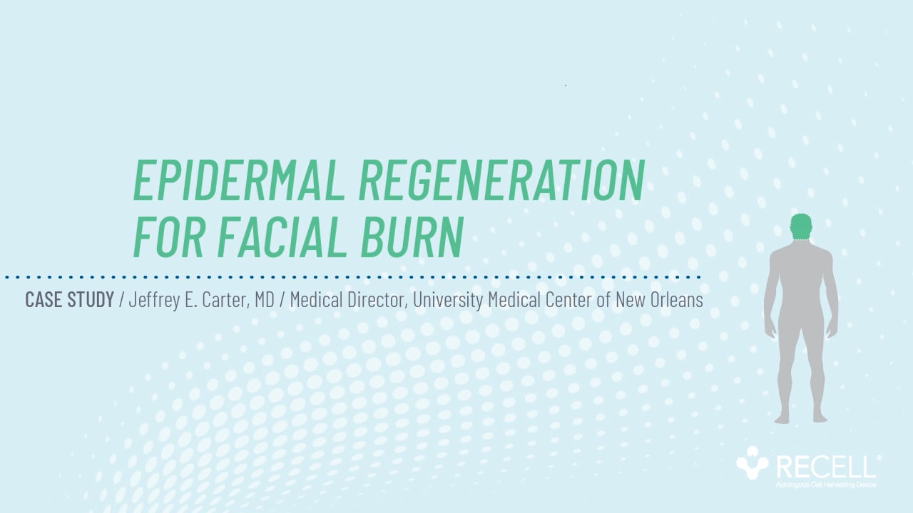 RECELL® System - Case Study 029: Epidermal Regeneration for Facial Burn