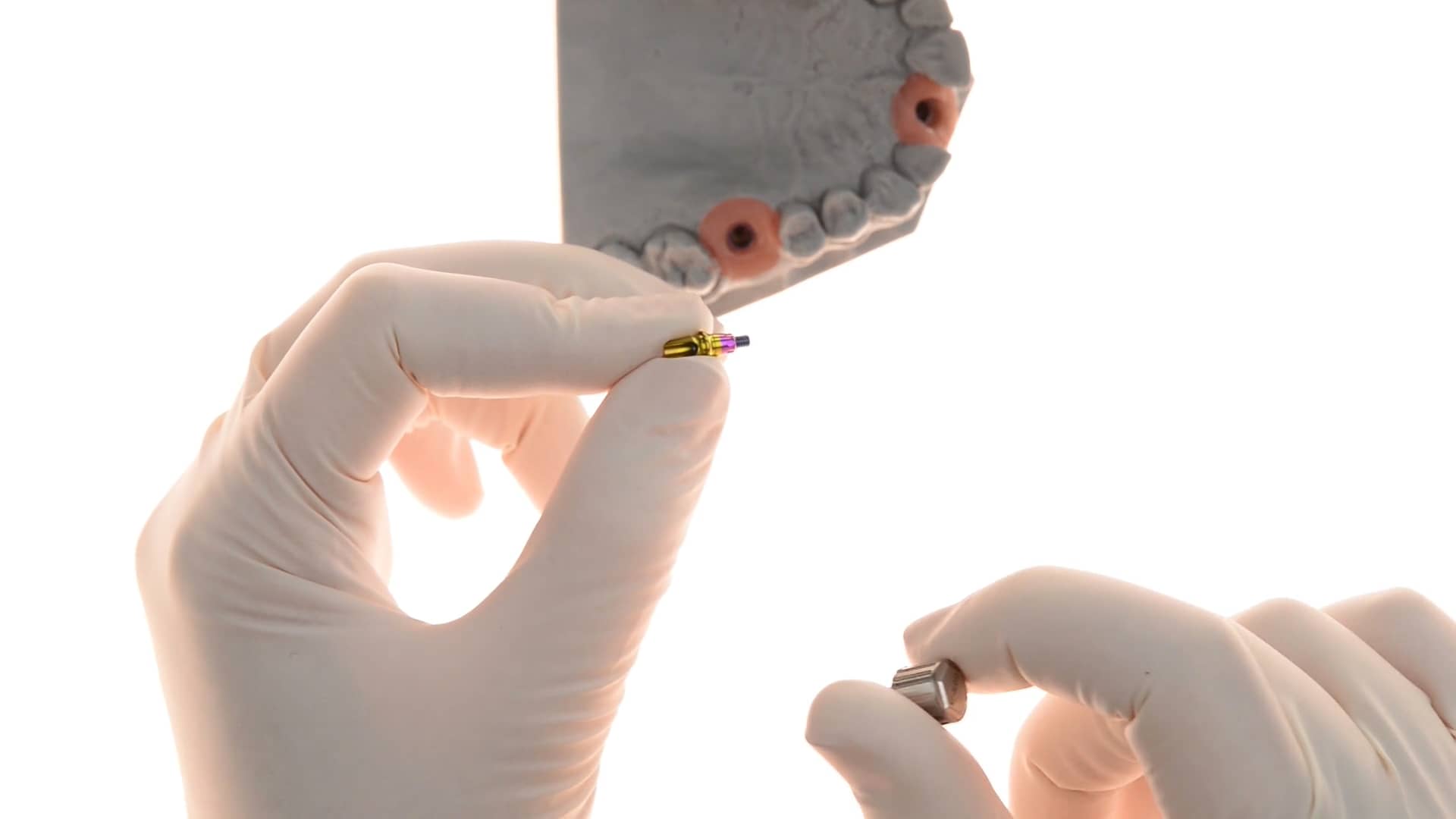 Using MIS EZ-Base abutment on Vimeo