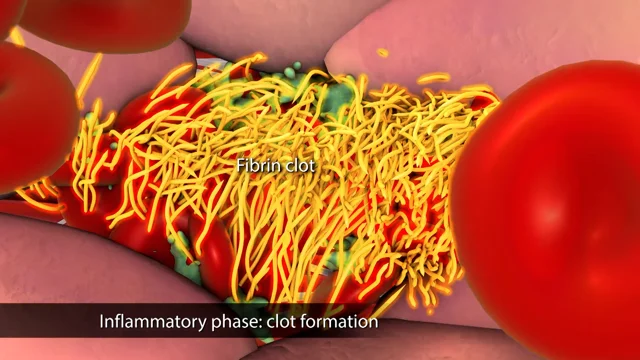 Fibrin Blood Clot