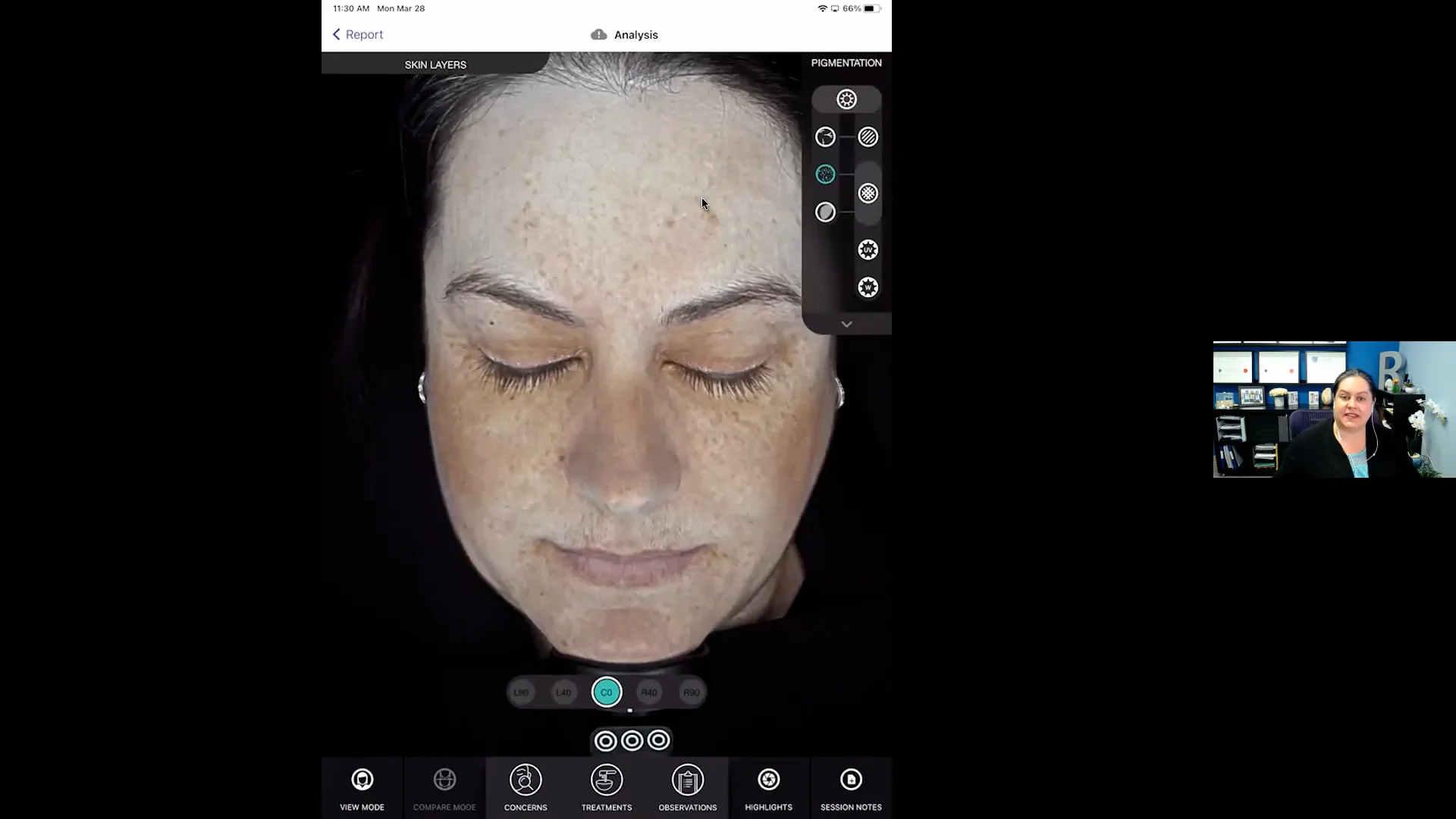 DermaSpark Academy - OBSERV session with Rene on Vimeo