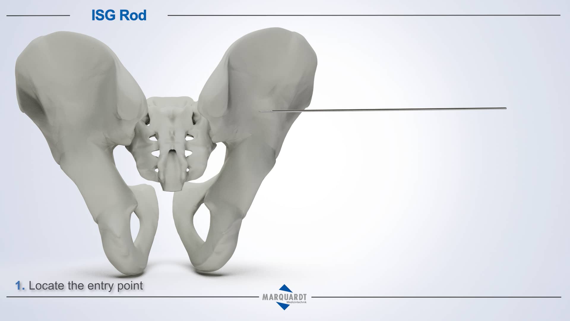 ISG_Stab_engl.mp4 on Vimeo