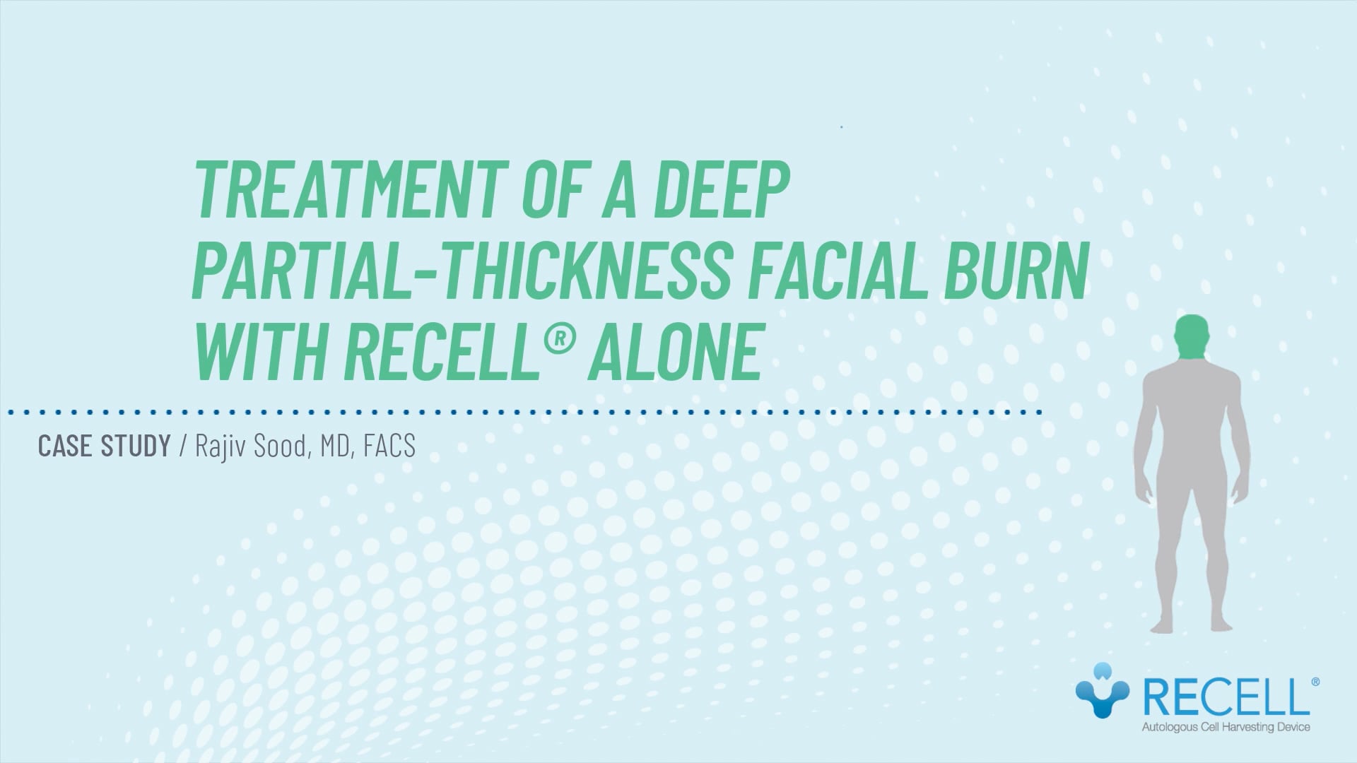 RECELL® System - Case Study 039: Treatment of a Deep Partial-Thickness ...