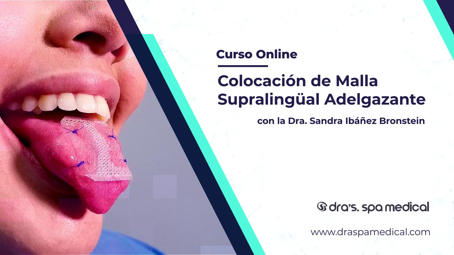 spot malla supralingual FINAL.mp4 on Vimeo