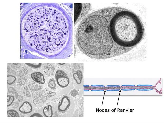Peripheral Nerve Histology Nodes Of Ranvier