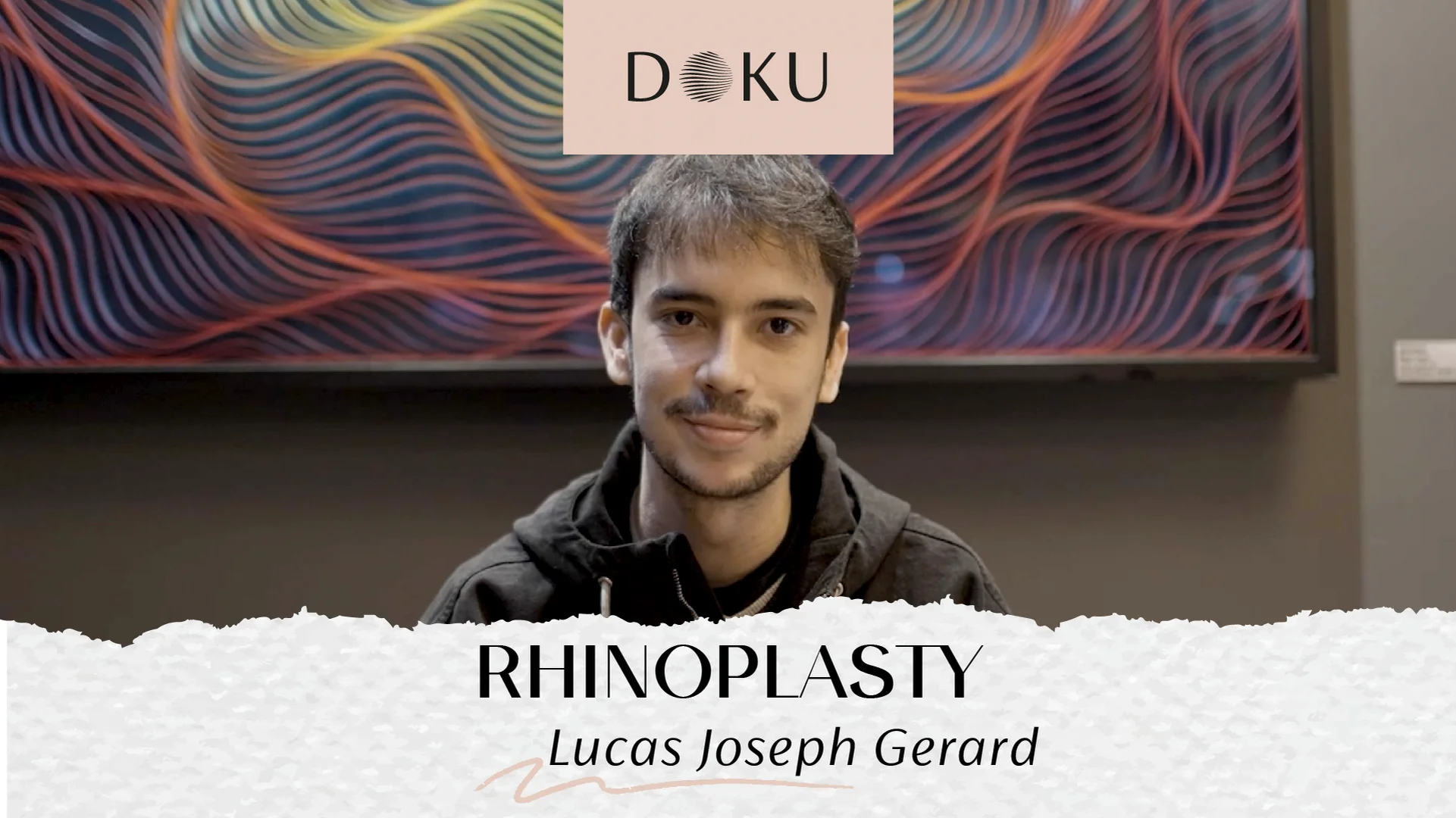 English - Rhinoplasty - Lucas Joseph Gerard on Vimeo