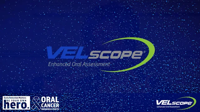 Velscope Price