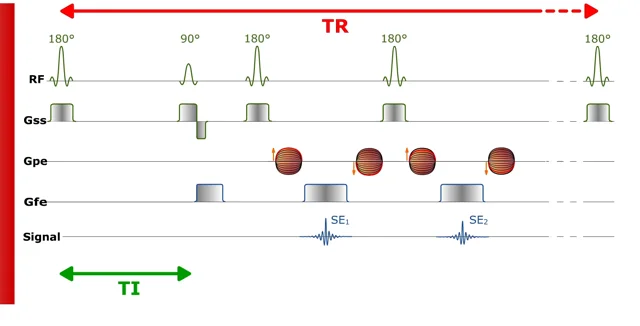 Inversion Recovery Spin Echo Pulse Sequence