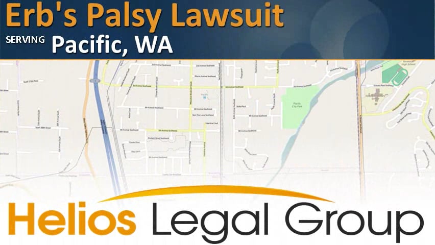 Pacific, WA - Erb's Palsy - Lawyer | Attorney | Lawsuit | Law Firm ...