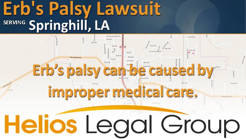 Springhill, LA - Erb's Palsy - Lawyer | Attorney | Lawsuit | Law Firm ...