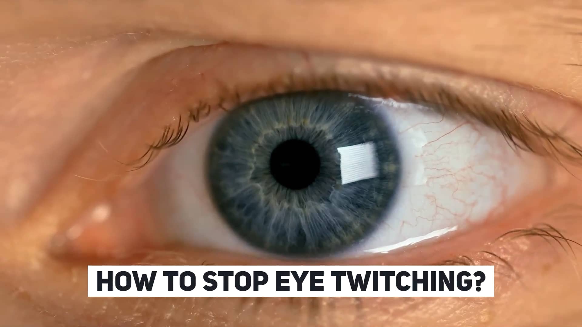 How To Stop Eye Twitching? Myokymia - Symptoms and Treatments on Vimeo