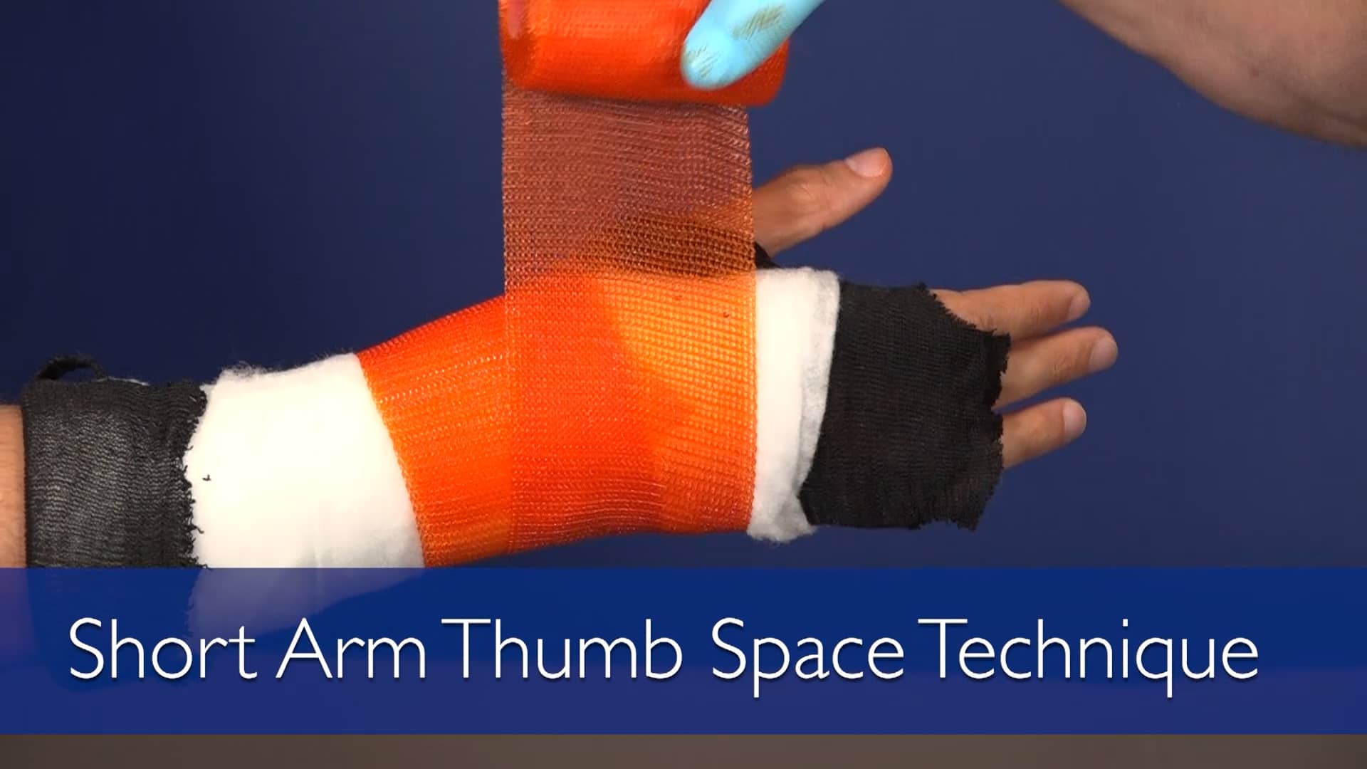 Short Arm Thumb Space Technique on Vimeo