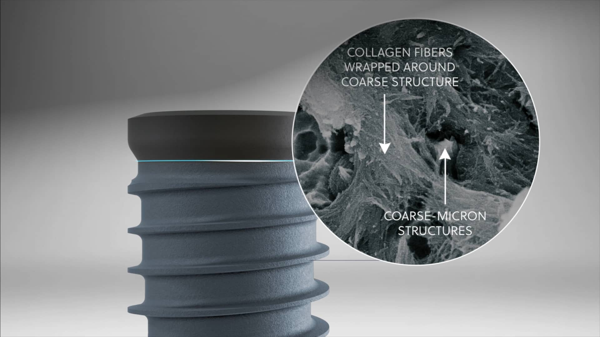 T3® PRO Tapered Implant on Vimeo