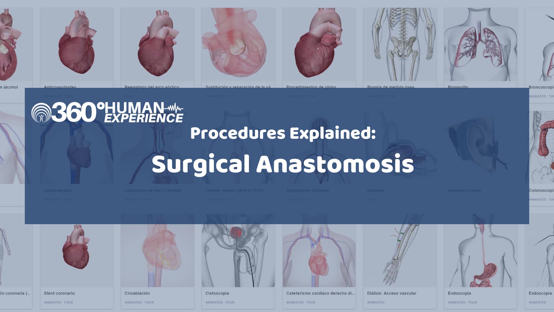 Surgical Anastomosis: Procedure Explained on Vimeo