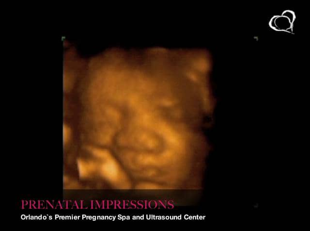 32 weeks - 3D Ultrasound Orlando - 4D Ultrasound Video taken in Orlando ...