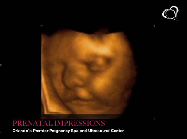 33 weeks - 3D Ultrasound Orlando - 4D Ultrasound Video taken in Orlando ...