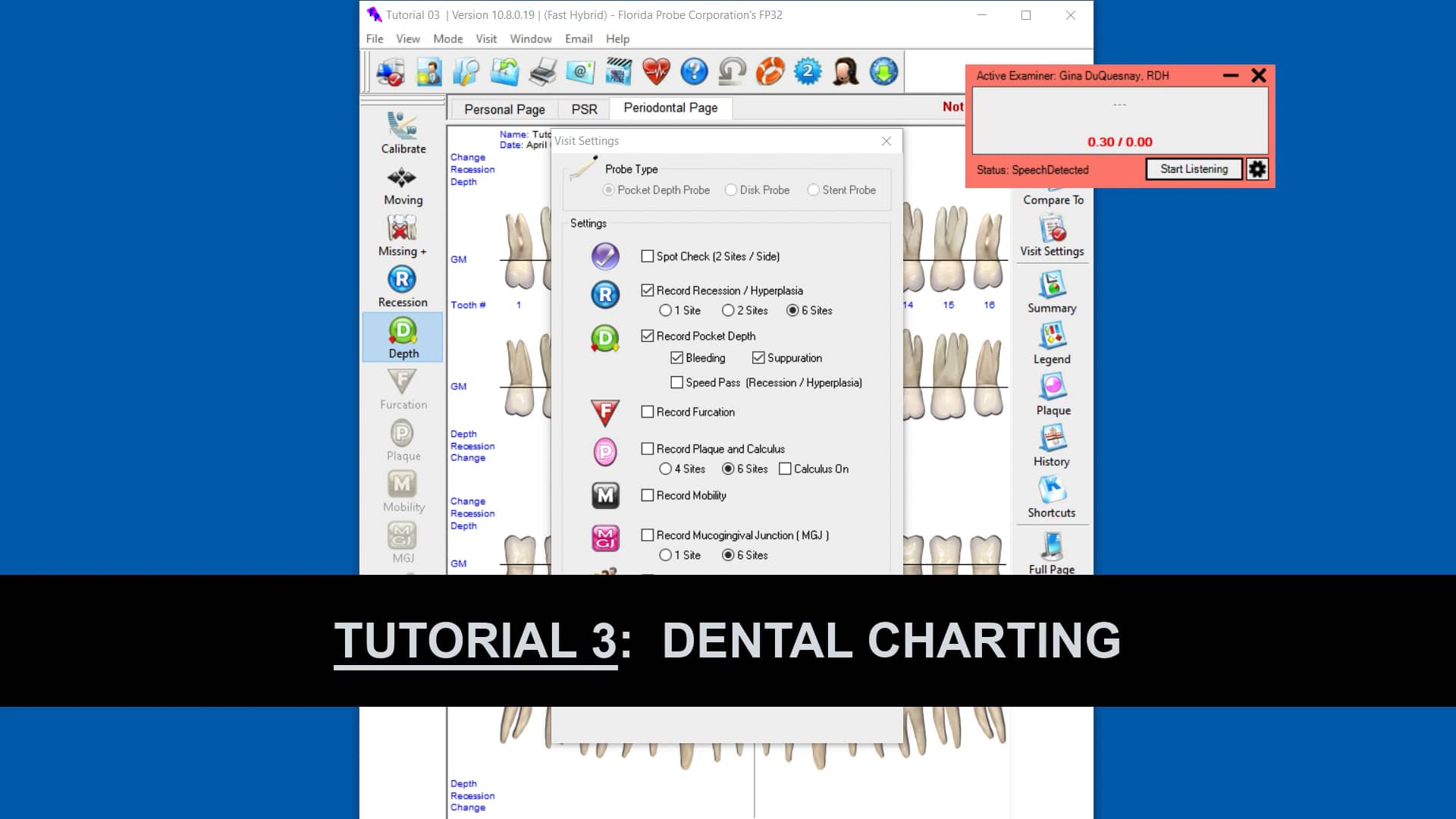 Tutorial 3: Dental Charting on Vimeo