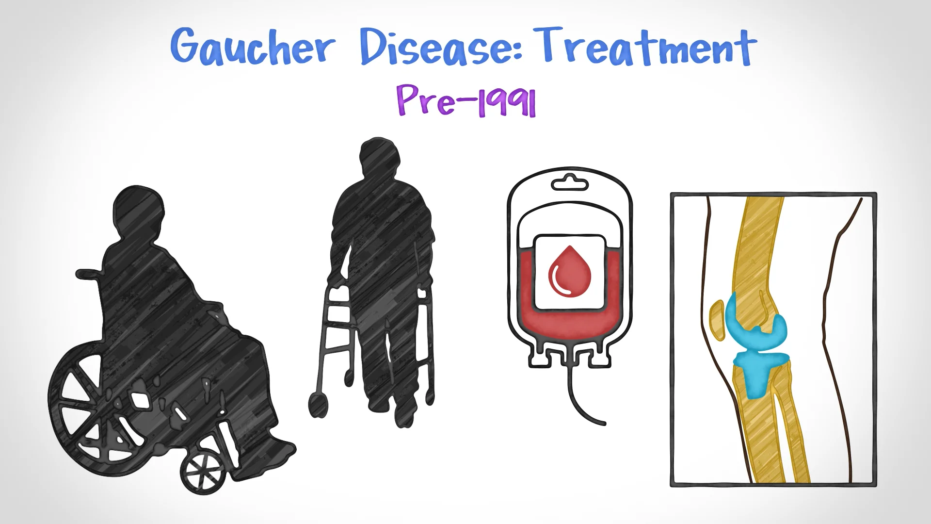 MLG Whiteboard - MLGWB Gaucher Disease: Enzyme Replacement Therapy in ...