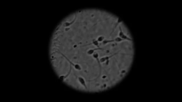 Sperm Microscope 400x