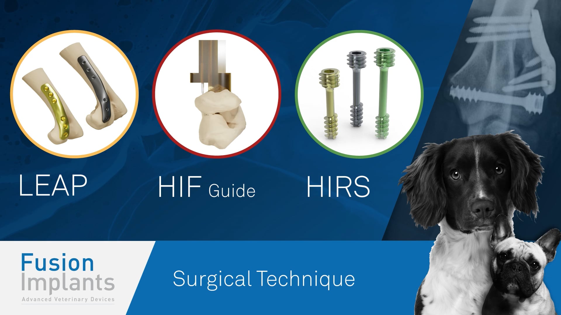 Fusion Implants Surgical Technique / LEAP / HIF Guide / HIRS