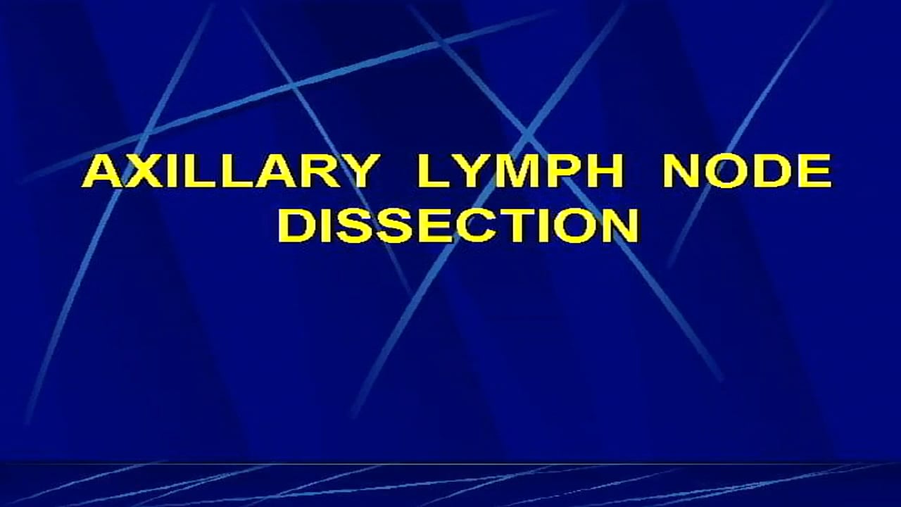 OPERATIVE PROCEDURES - Dr Stephan Ariyan - LYMPH NODE DISSECTION ...