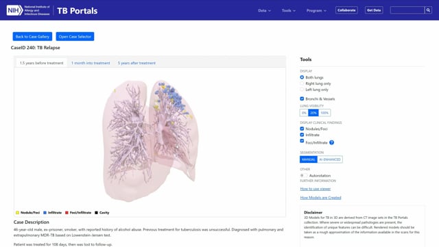 Journal of Biocommunication - TB in 3D on Vimeo