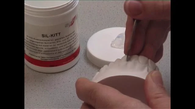 SCHEU Dental BIOSTAR 製作範例 - splint on Vimeo