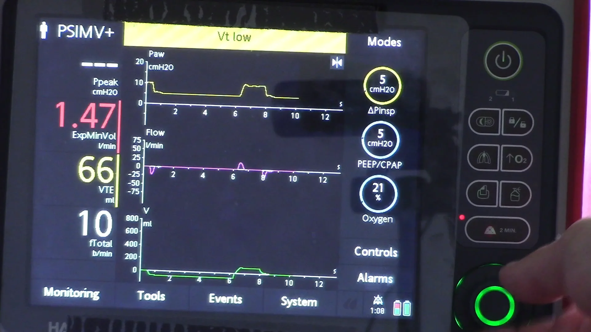 Troubleshooting when Switching from ASV to PSIMV on Vimeo