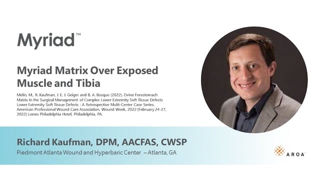 Myriad Matrix™ | AROA