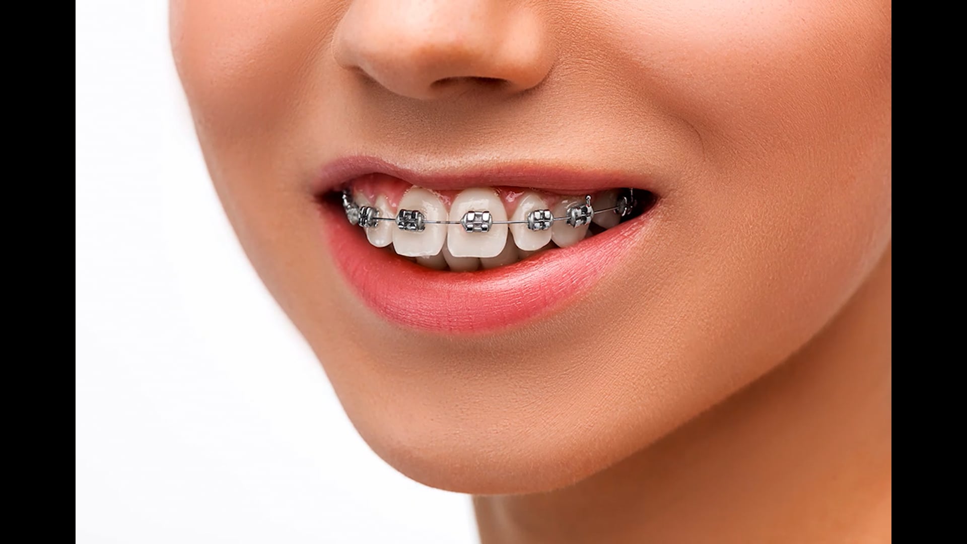 Family Dentist in Mississauga - Eglinton Oak Dental Center