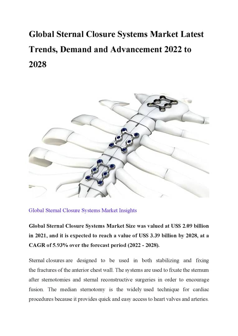 Global Sternal Closure Systems Market Latest Trends, Demand and ...