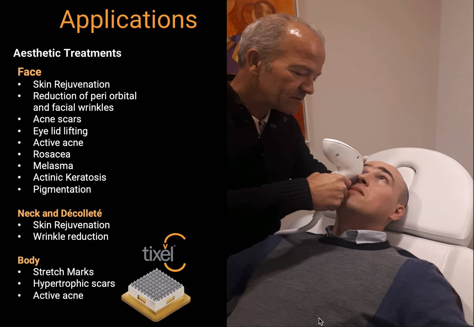 Tixel Eye Treatment.mov on Vimeo