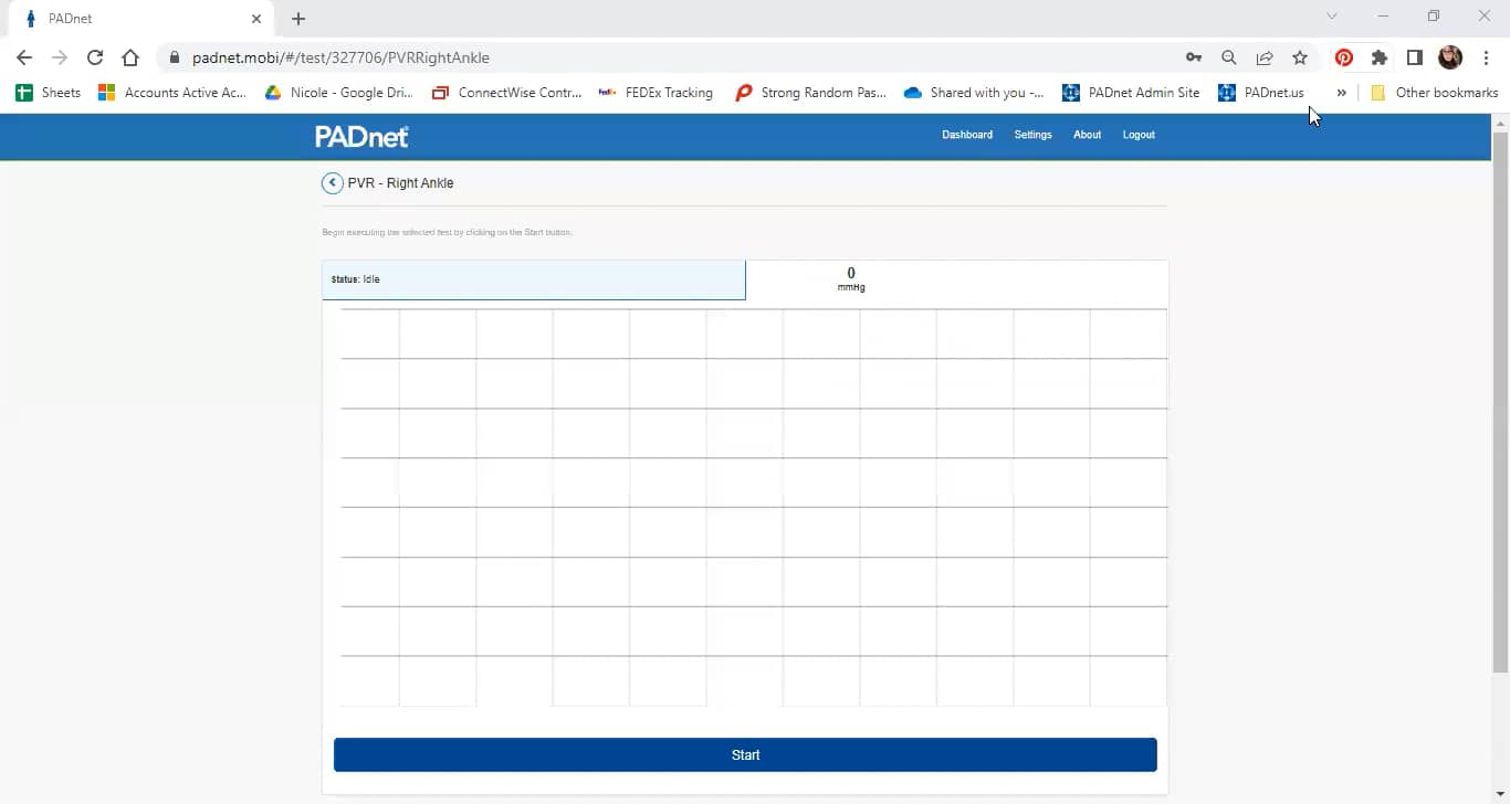 PADnet PVR Test on Vimeo