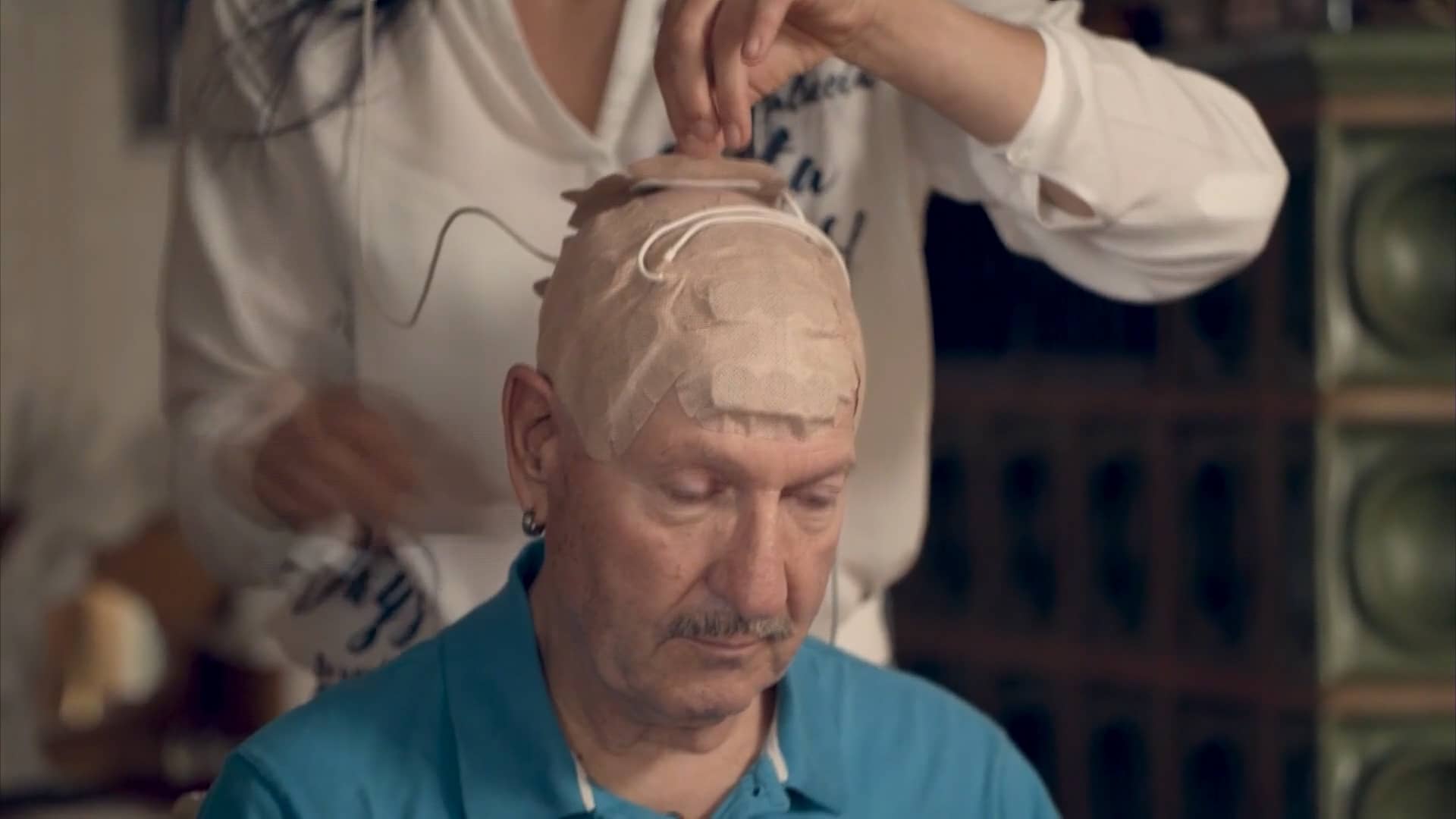 Optune Brain Tumor Treatment Options on Vimeo