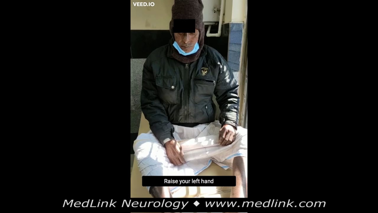 Pathologic yawning | MedLink Neurology