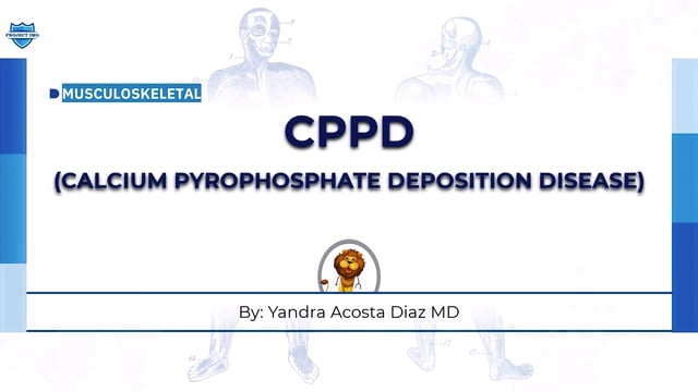 CPPD (Calcium Pyrophosphate Deposition Disease) on Vimeo