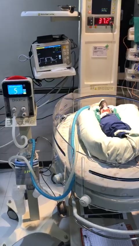 Use as Bubble CPAP 2.mp4 on Vimeo