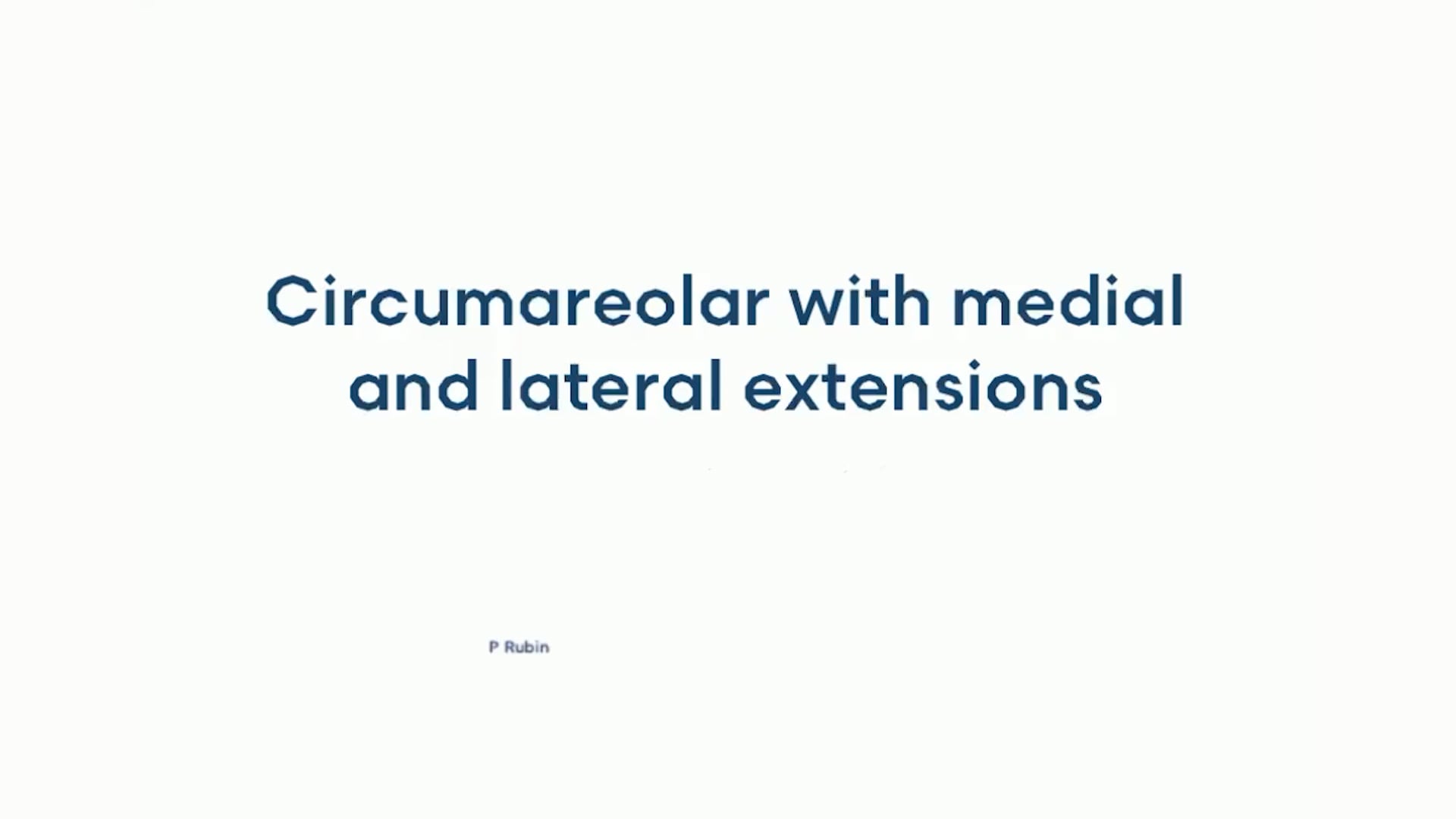 Circumareolar with medial and lateral extensions technique on Vimeo