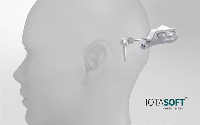 iotaSOFT Insertion System Introduction Video on Vimeo