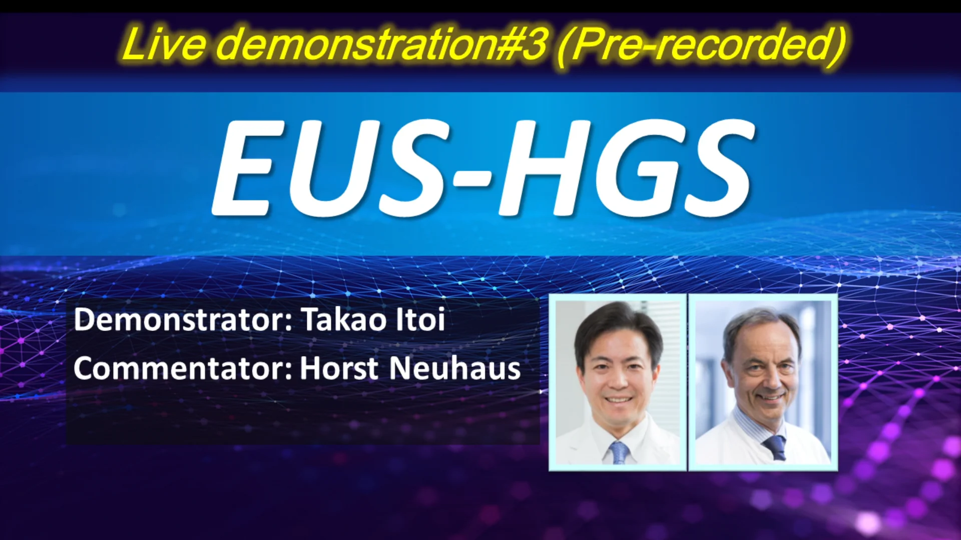 EUS-HGS by Dr.Takao Itoi